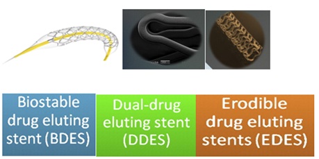 Safety and Efficacy of Drug-Eluting Stents Improved Dramatically with ...
